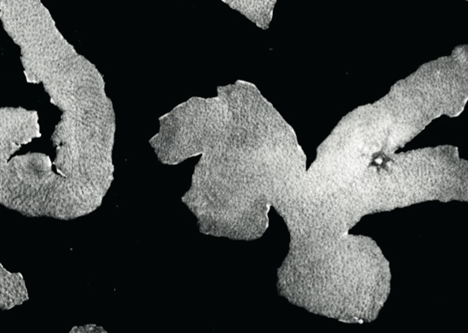 Mira Klug “Verschluckt” — Klasse Fotografie Gabriele Rothemann